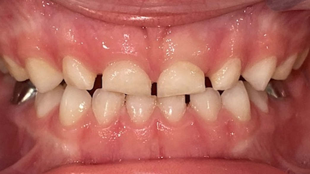 Growth & Development - Beyond Pediatric Dentistry